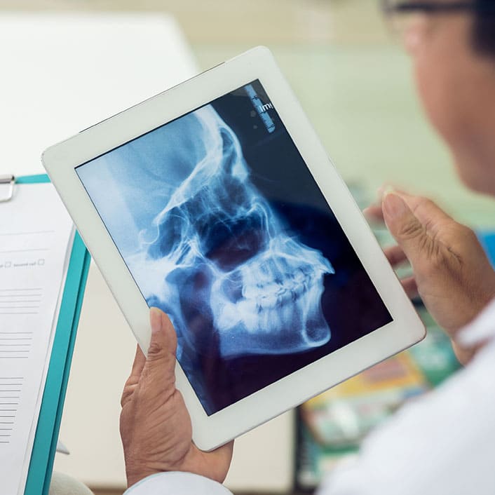 Wisdom Teeth Services | Tobias Maynard DDS, Inc. | Redlands, CA